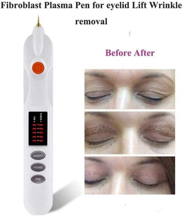 Plasma pen Beauty Monster – Aparatos Belleza